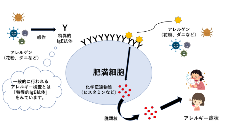 アレルギー性鼻炎 | 葛西よこやま内科・呼吸器内科クリニック｜江戸川区東葛西の内科・呼吸器内科・アレルギー科